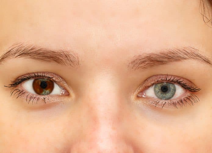 Entenda a heterocromia, uma linda anomalia genética - Olhar Digital